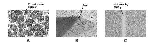 Artifacts in Histologic Sections - National Diagnostics
